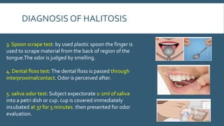 Halitosis - bad breath presentation | PPTX