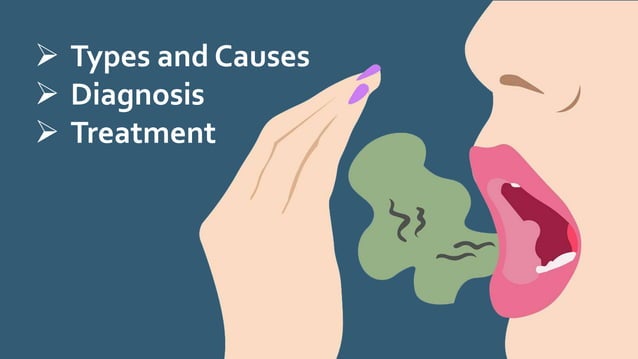 Halitosis - bad breath presentation | PPTX