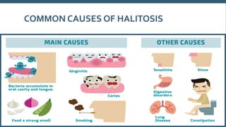 Halitosis - bad breath presentation | PPTX