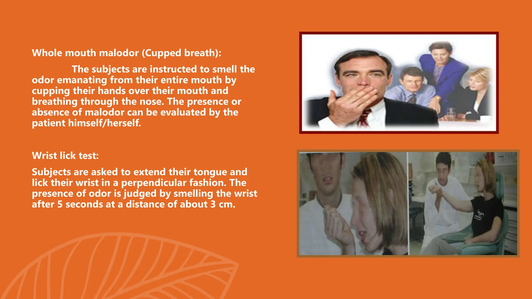 Halitosis ORAL MALODOR PERIODONTICSNTICS | PPTX