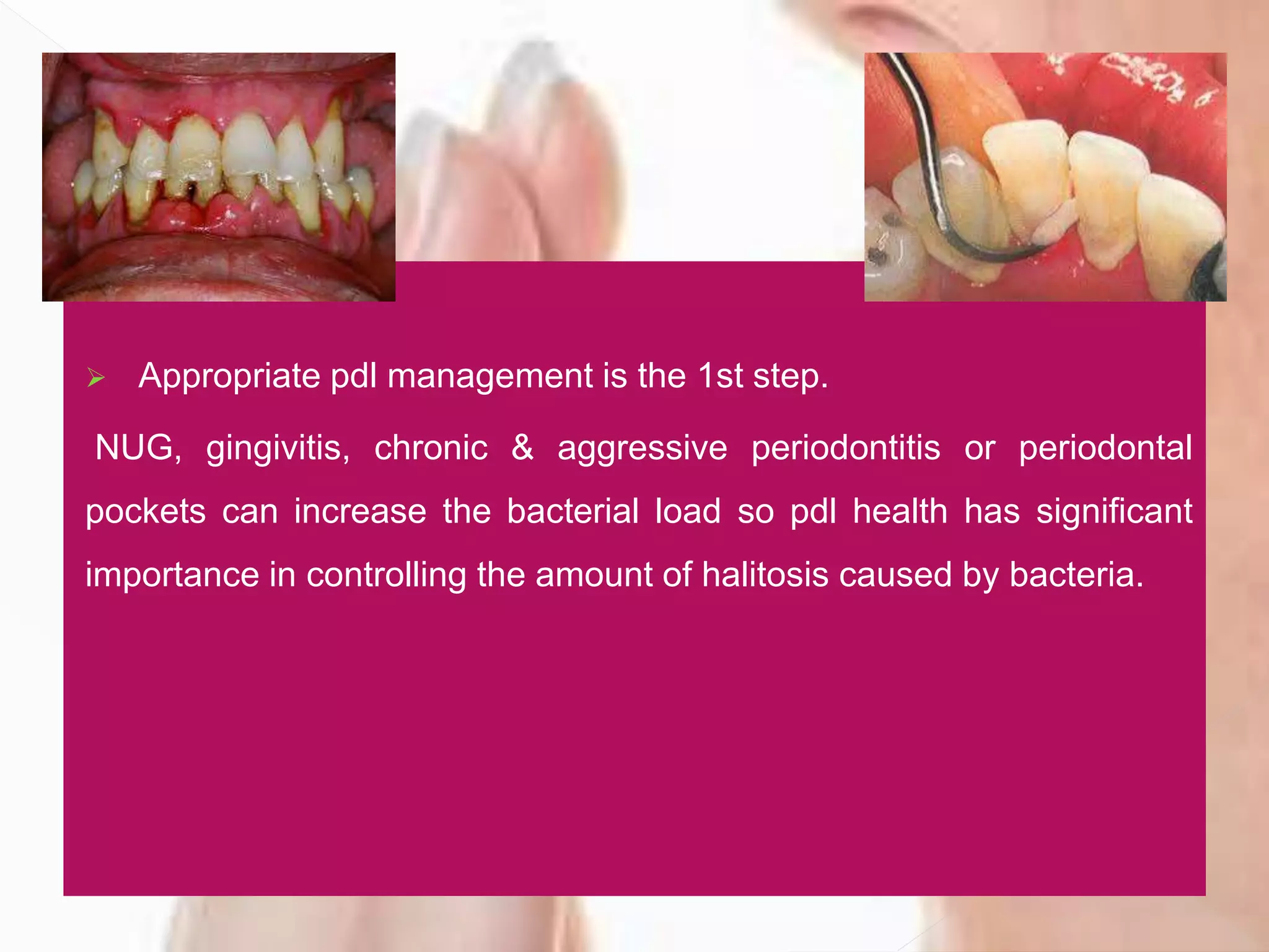 Halitosis DR SINDHURA.pptx