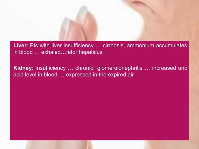 Halitosis DR SINDHURA.pptx