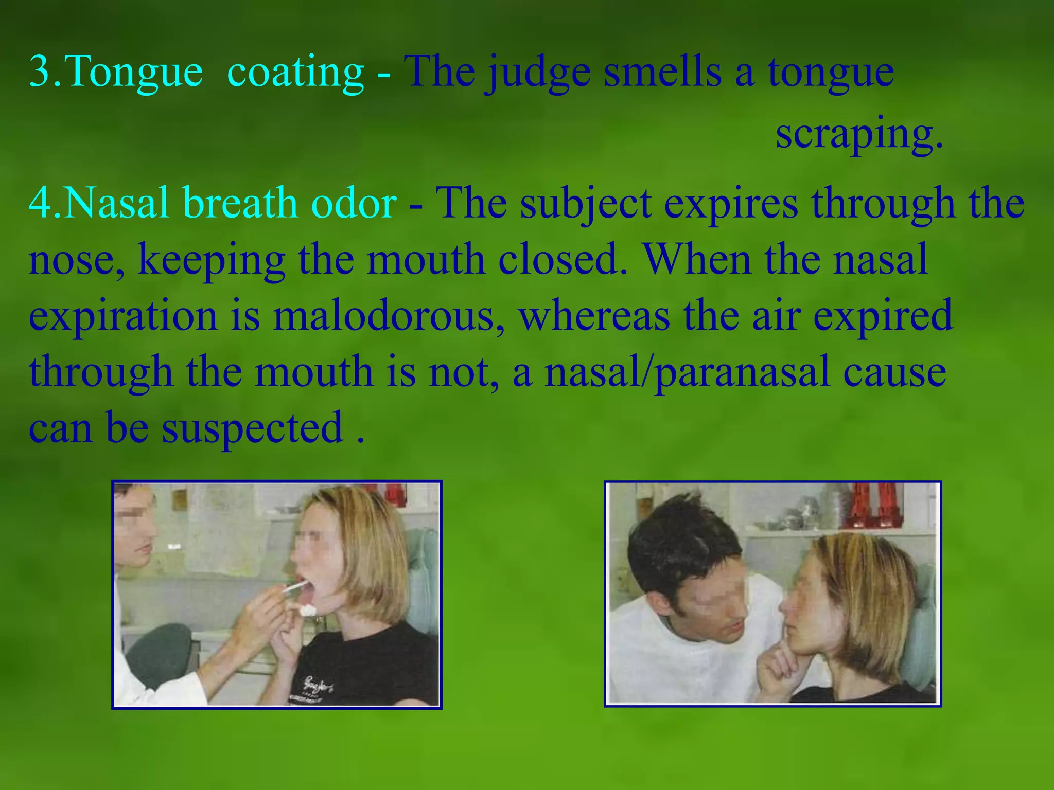 HALITOSIS_PPT.ppt