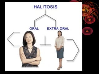 Halitosis | PPT