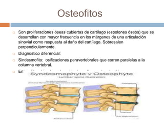 Hallazgos patológicos de la columna.pptx