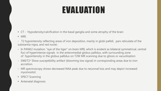 Hallervorden Spatz Disease | PPTX