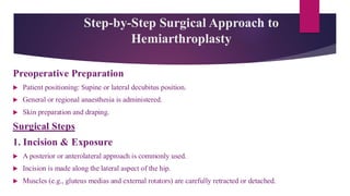 HEMIARTHROPLASTY FEDERAL TEACHING HOSPITAL KATSINA.pdf