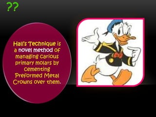 Hall technique | PPT