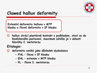 Hallux flexus + Clawed hallux | PPTX