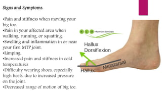 Hallux rigidus | PPTX