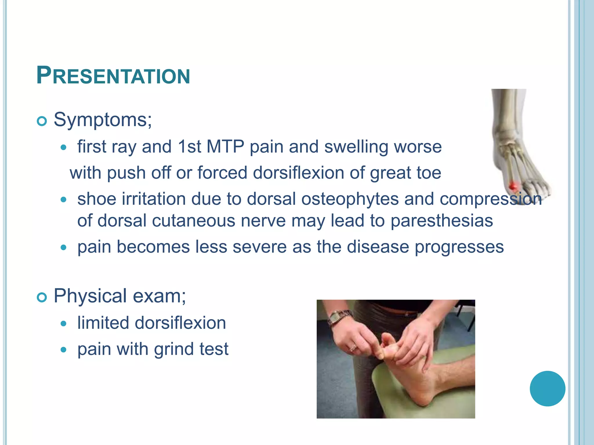 Hallux rigidus | PPTX