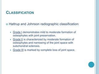 Hallux rigidus | PPTX
