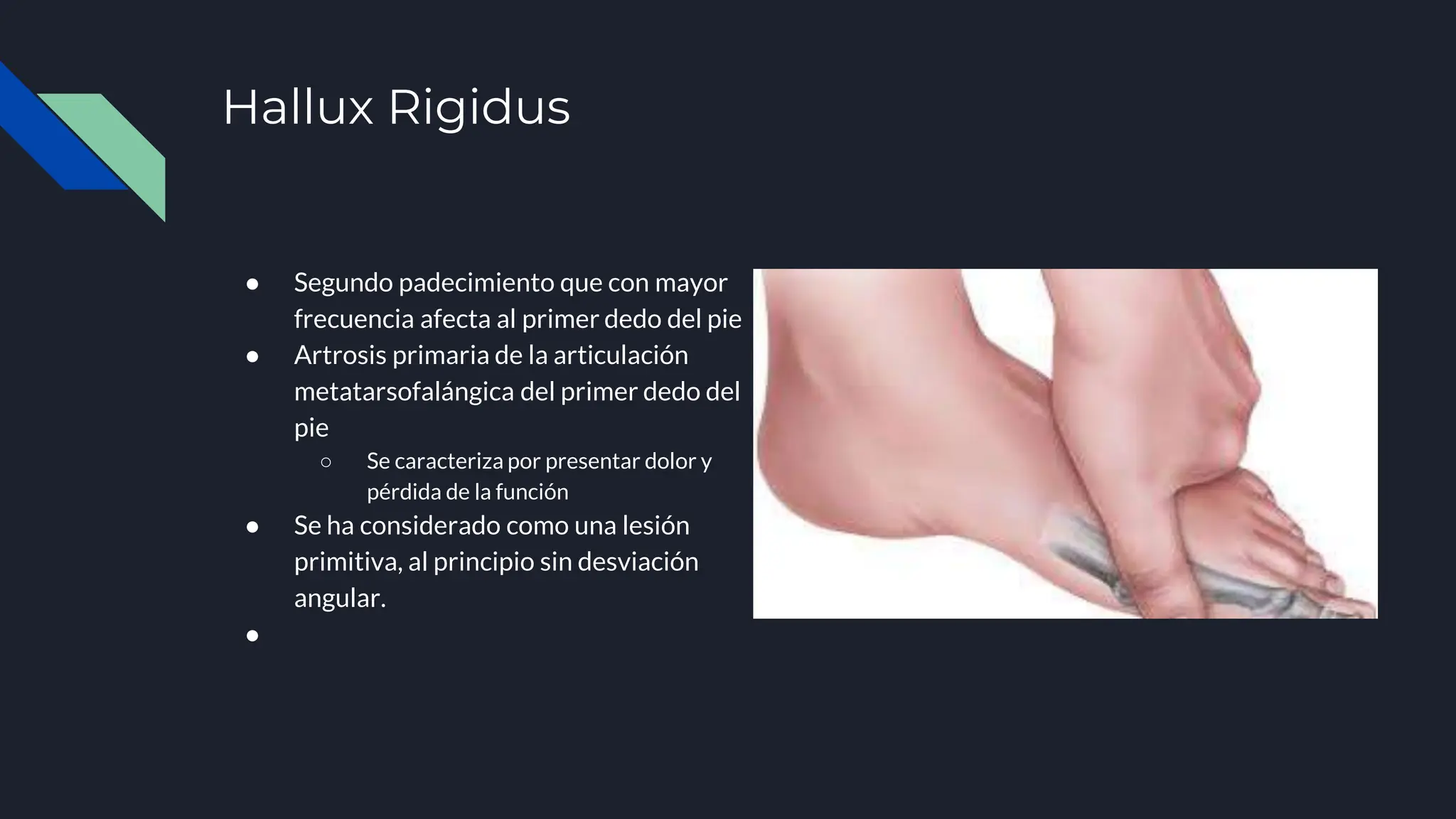 Hallux Rigidus y Hallux Varus revisión. .pptx | Foot Health | Diseases ...