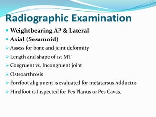 Hallux valgus UG lecture | PPTX