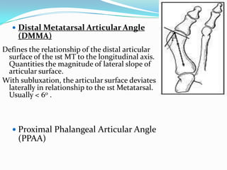 Distal Metatarsal Articular Angle