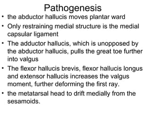 Hallux valgus | PPT
