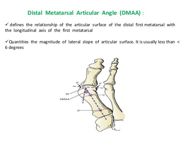 Distal Metatarsal Articular Angle Hall