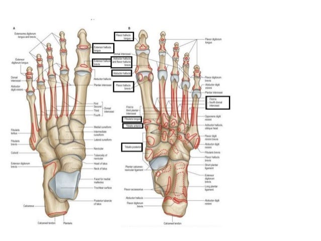 Hallux Valgus - A Detailed Outline