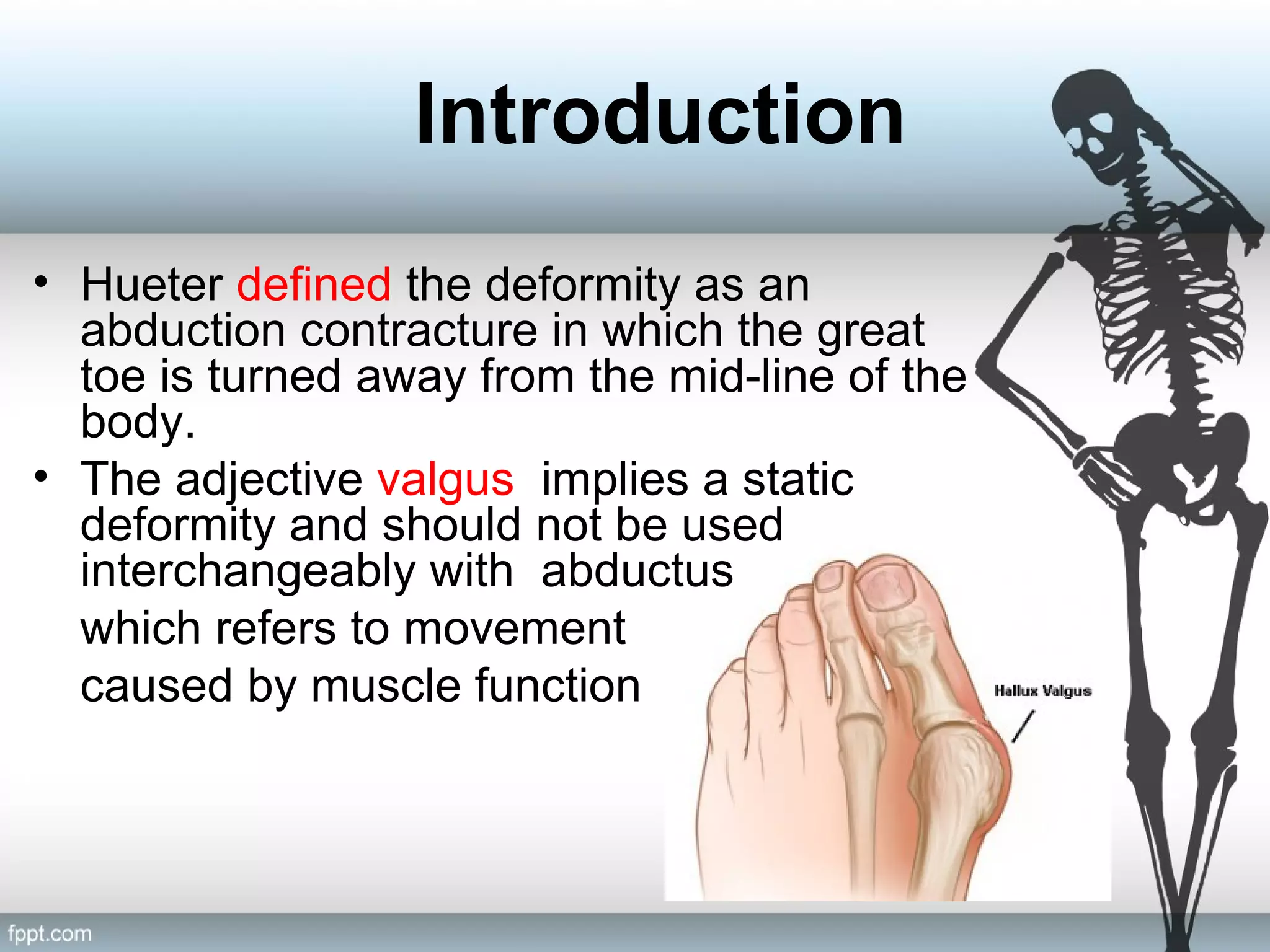 Hallux valgus.pptx