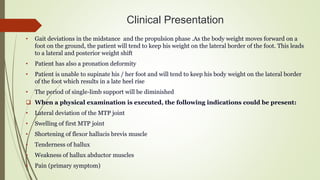 Hallux valgus Deformity | PPTX