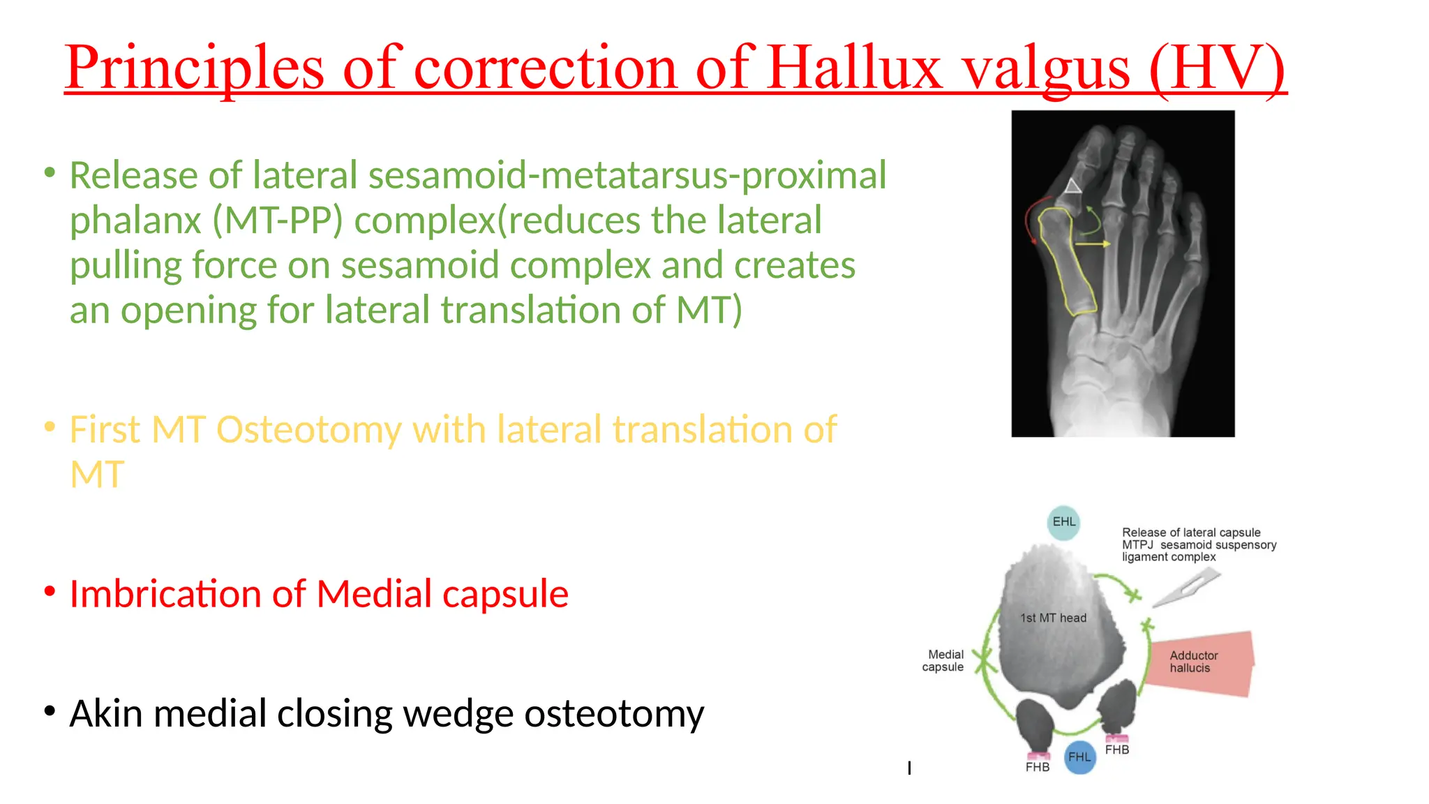 Hallux Valgus Principles and Management | PPTX