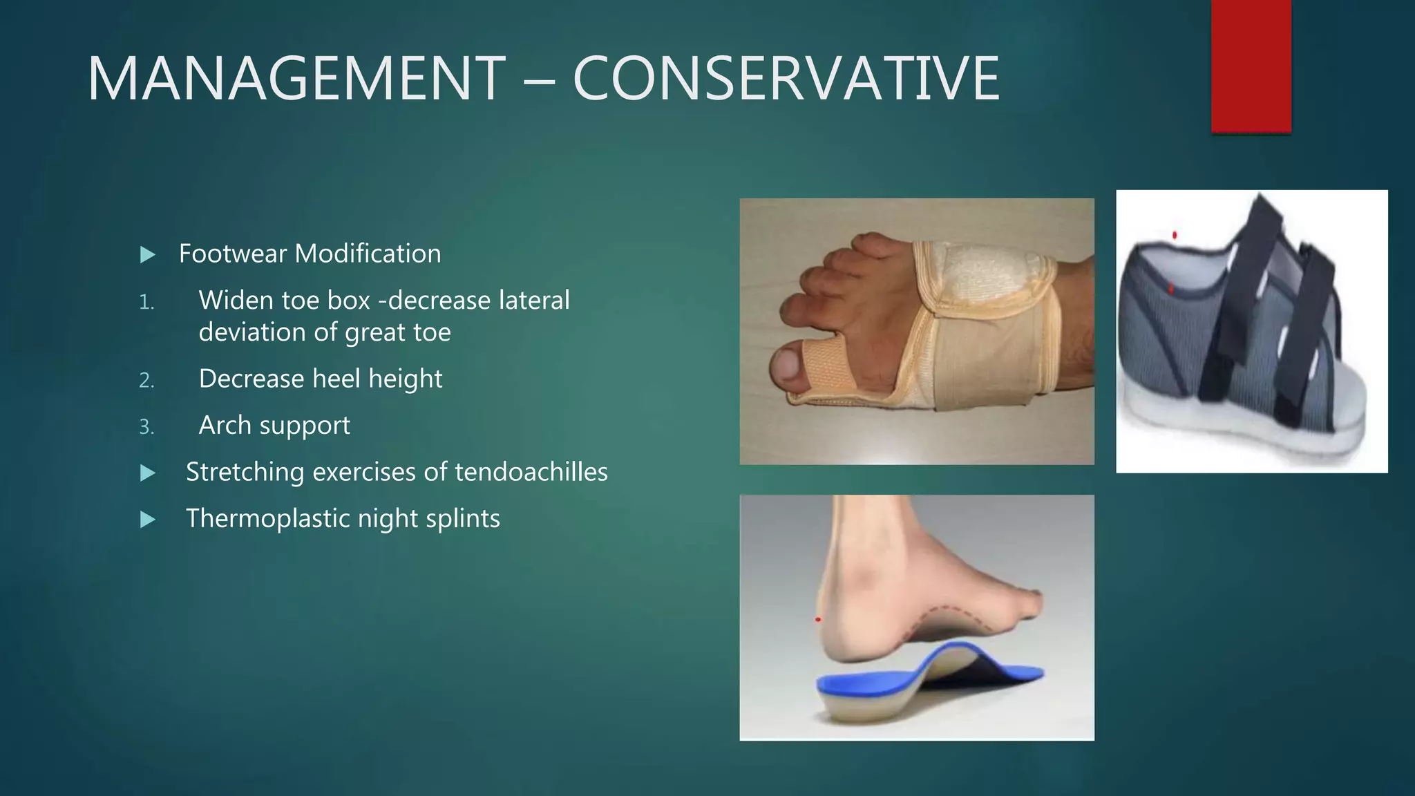 Hallux valgus - Practical approach and recent advances | PPTX