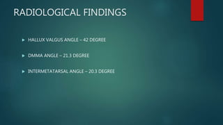 Hallux valgus - Practical approach and recent advances | PPTX | Death ...
