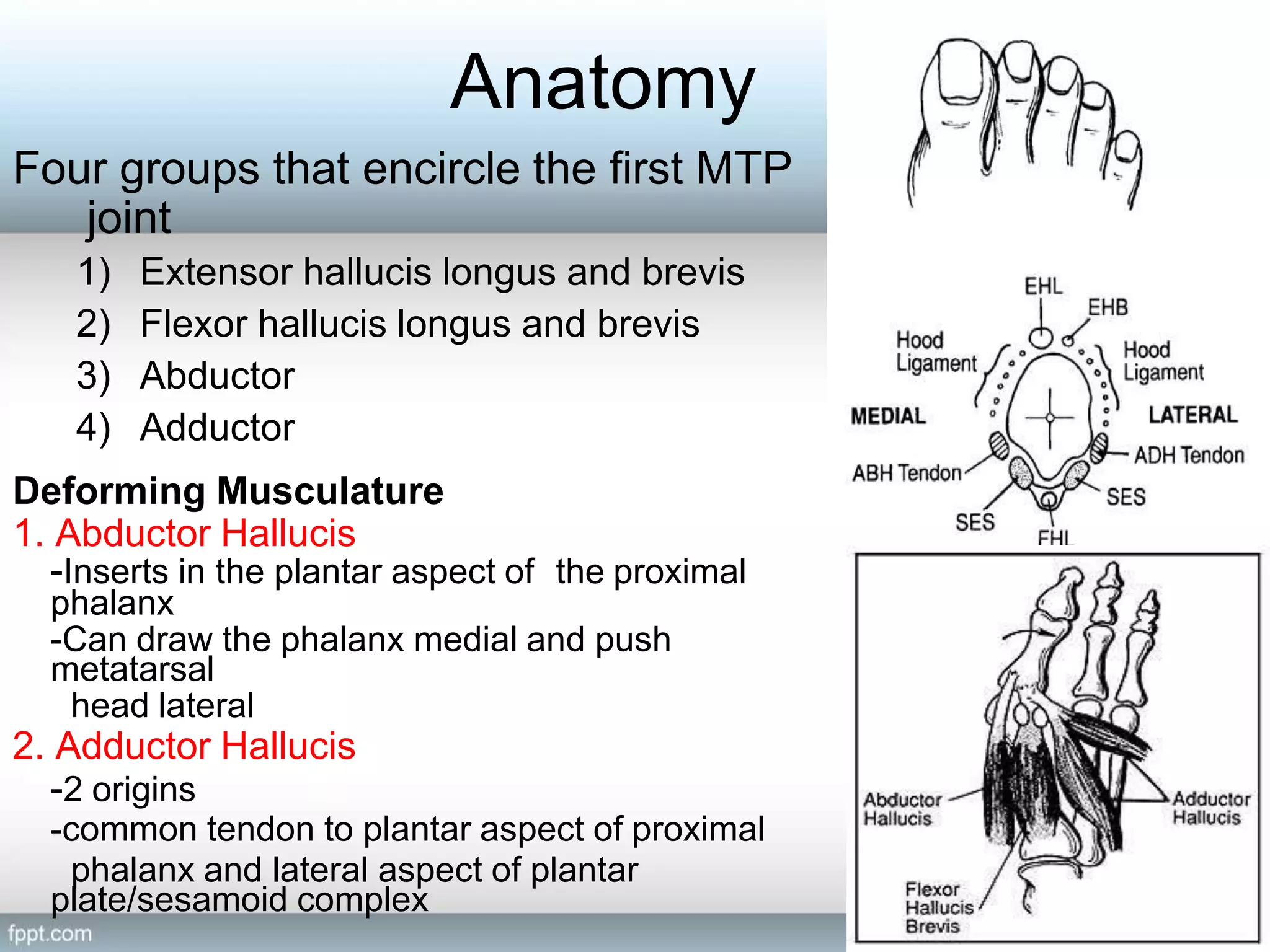 hallux valgus.pptx
