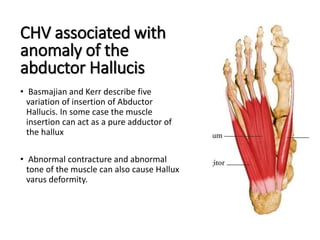 Congenital Hallux varus: How to deal with it? | PPTX