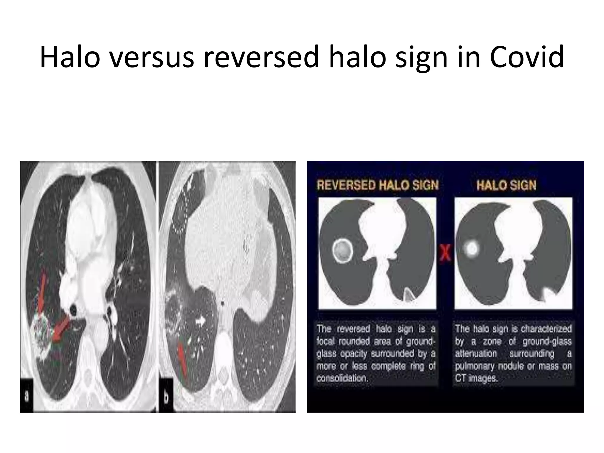 HALO SIGN.ppt