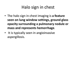 HALO SIGN.ppt