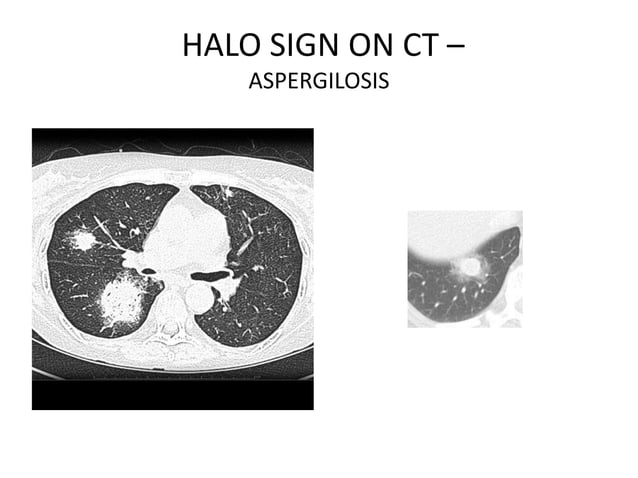 HALO SIGN.ppt