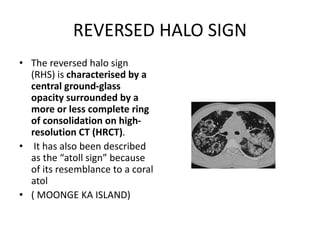 HALO SIGN.ppt
