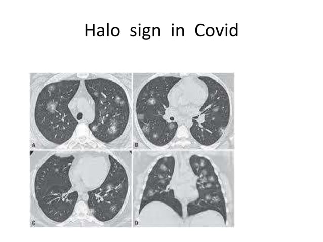 HALO SIGN.ppt