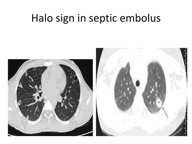 HALO SIGN.ppt