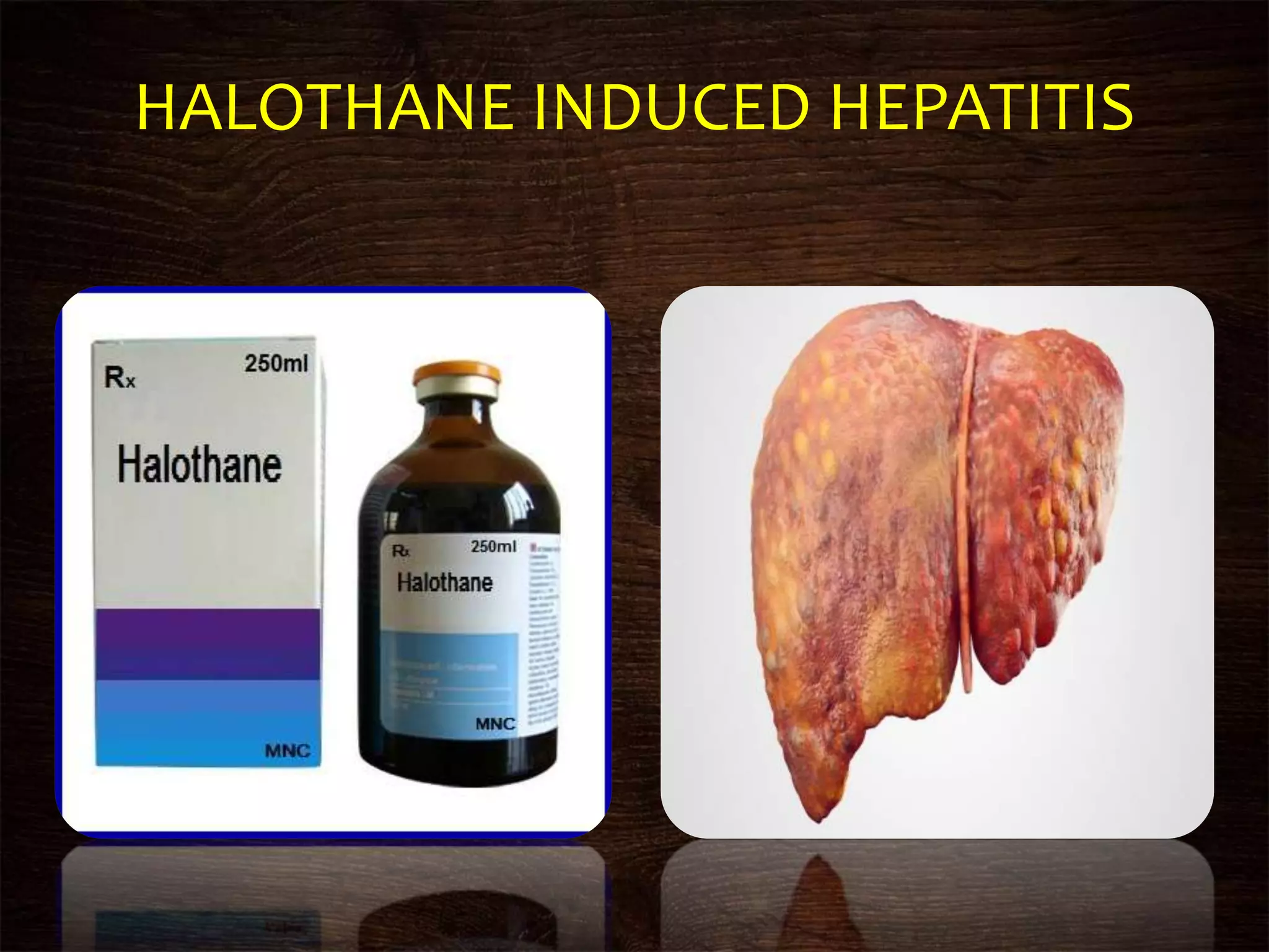 Halothane induced hepatitis | PPTX