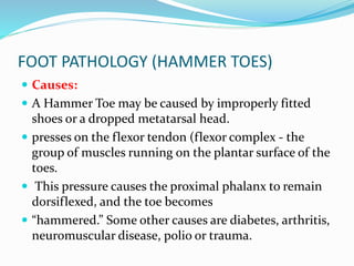 Hammer toes | PPTX