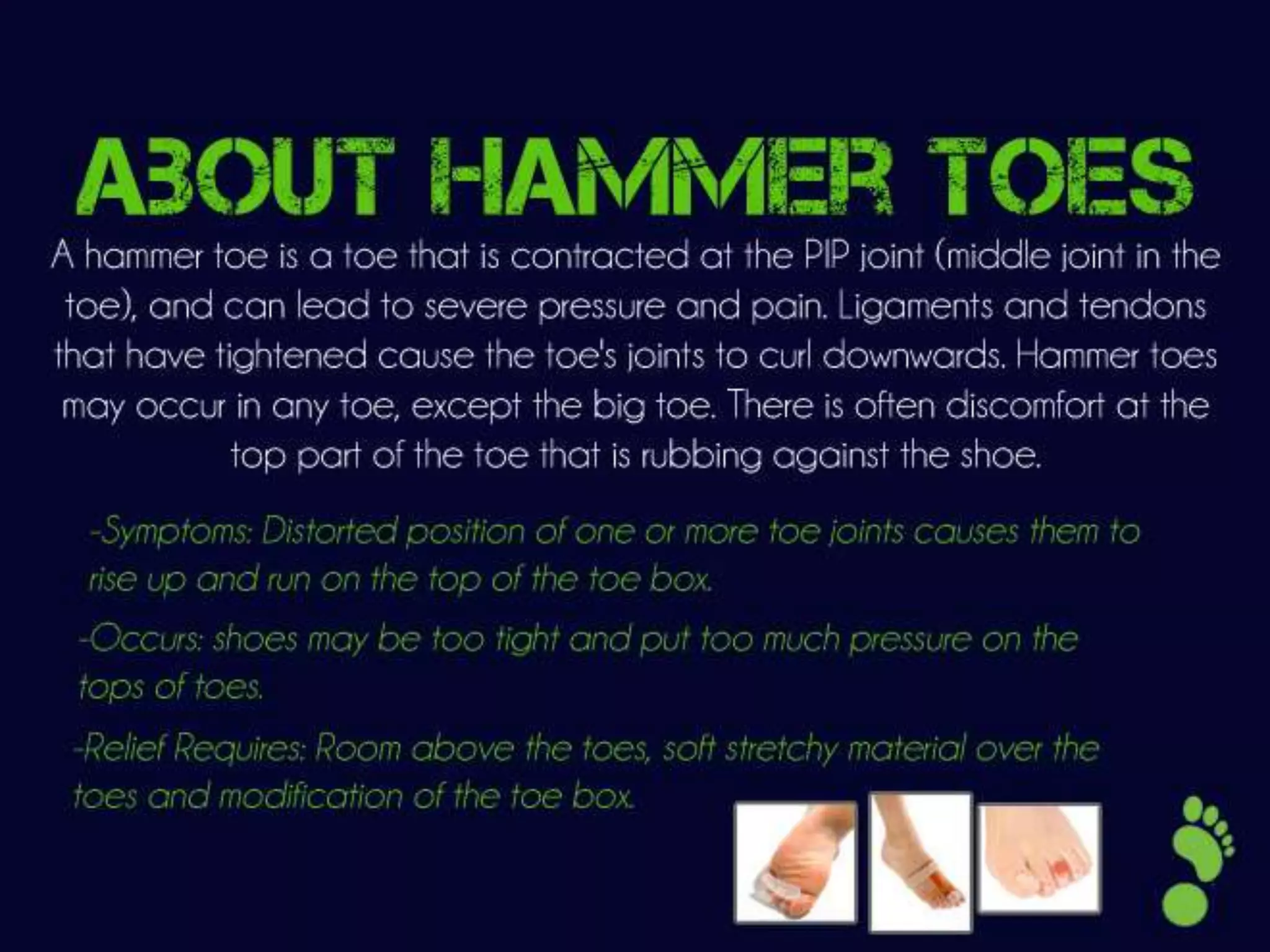 Hammer toes information & treatments | PPTX