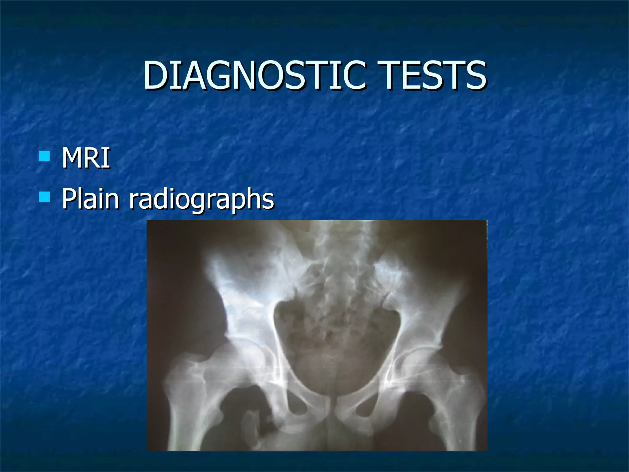 Hamstring Avulsion Repair Rehabilitation | PPT