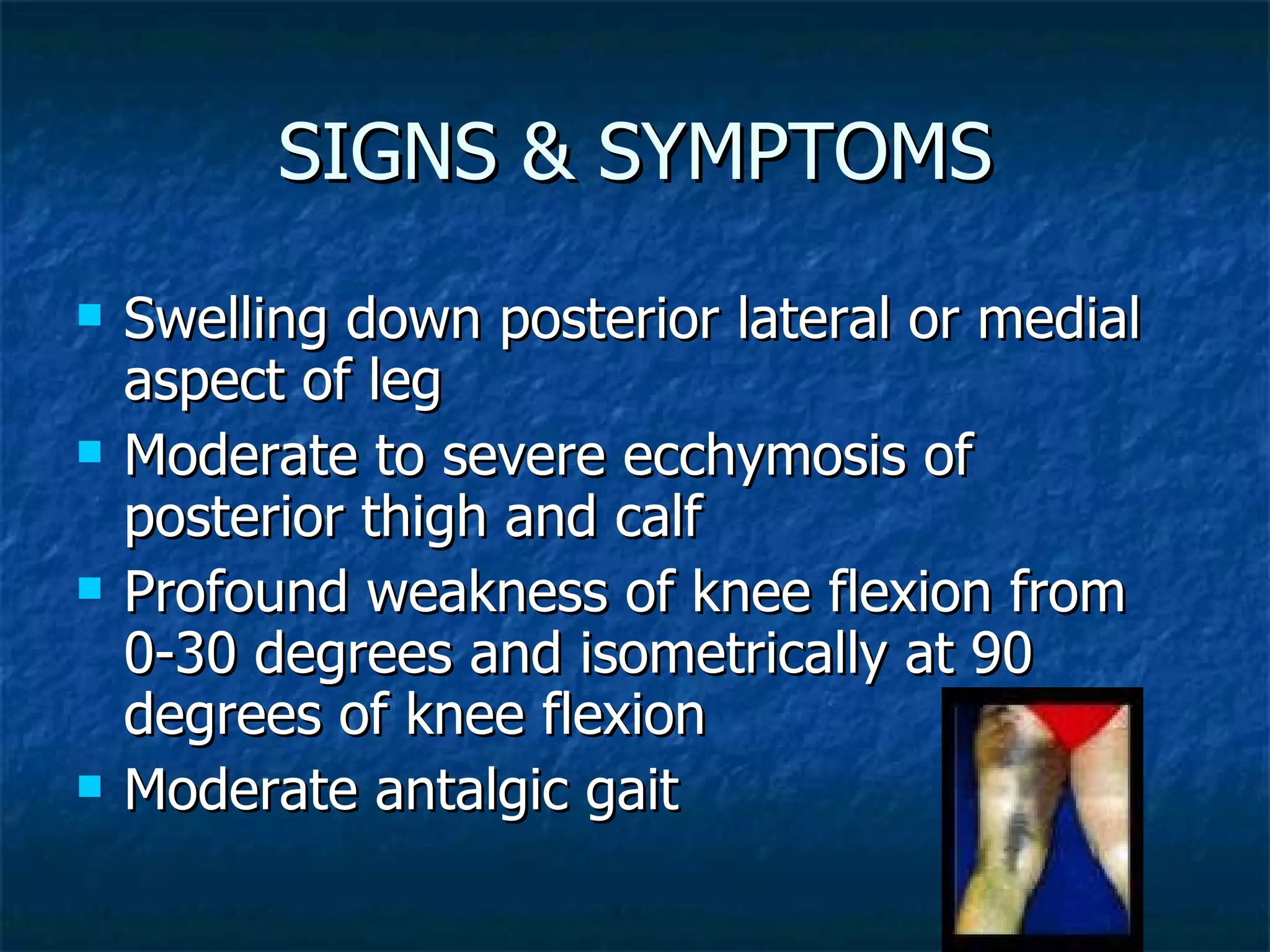 Hamstring Avulsion Repair Rehabilitation | PPT