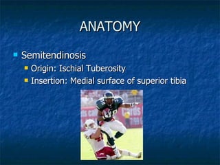Hamstring Avulsion Repair Rehabilitation | PPT