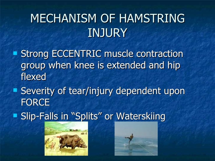 Hamstring Avulsion Repair Rehabilitation