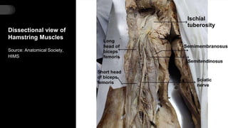 Hamstring Muscles (1).pptx