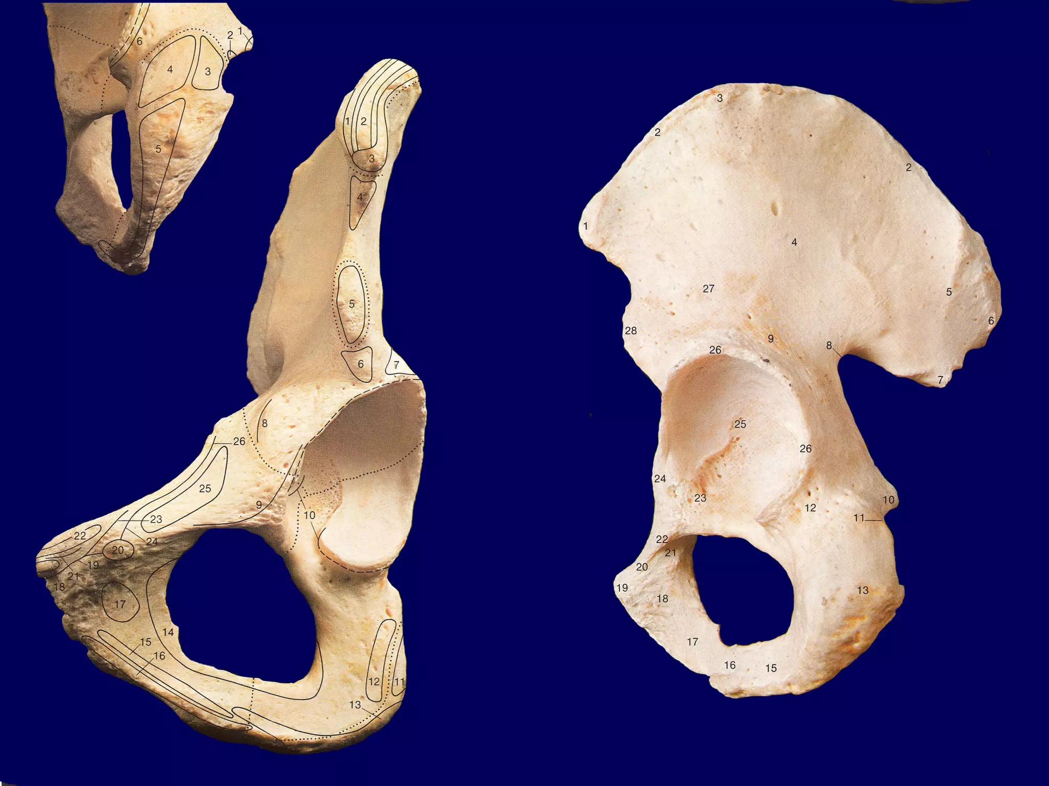 Hamstrings sciatic nerve | PPT
