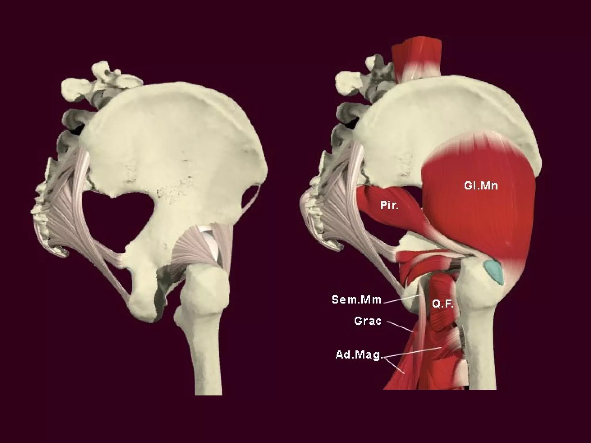 Hamstrings sciatic nerve | PPT