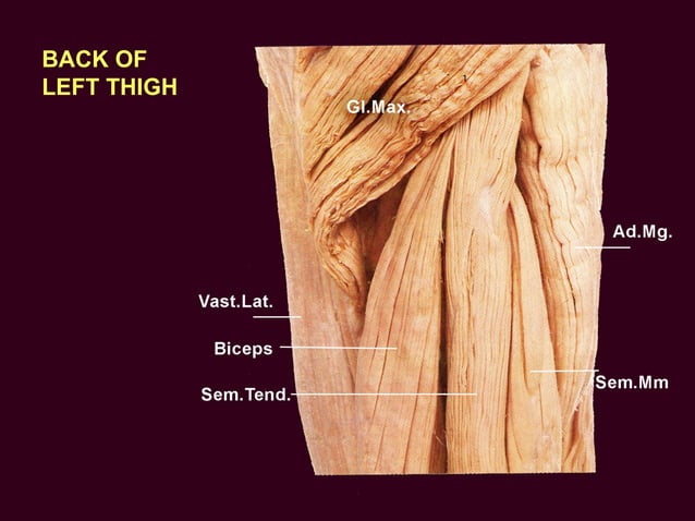 Hamstrings sciatic nerve | PPT
