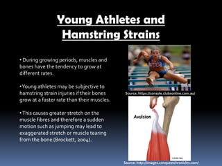 Hamstring strain pp | PPTX