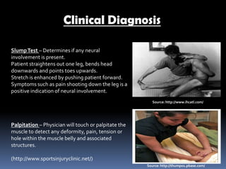 Hamstring strain pp | PPTX