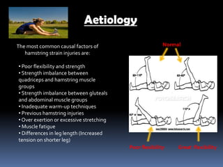 Hamstring strain pp | PPTX