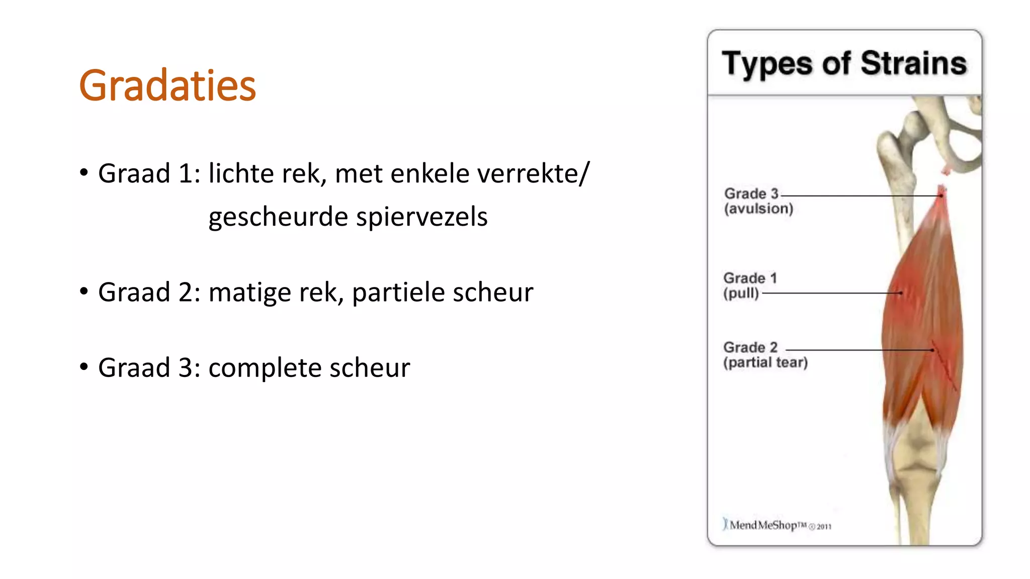 Hamstring tendinopathy | PPTX